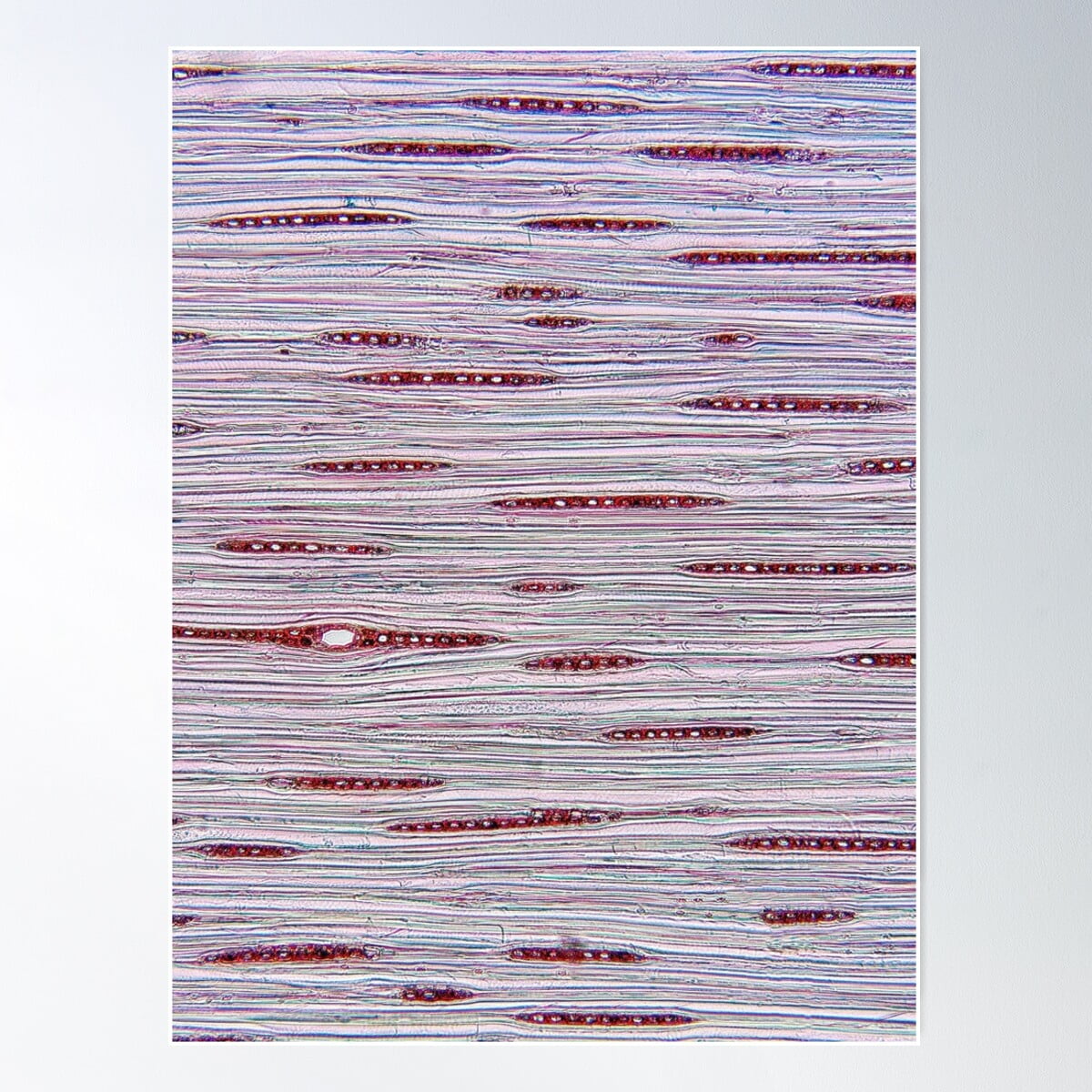 Larch Tree, Wood Cells; Plant Anatomy, Microscopy Poster Wall Art ...