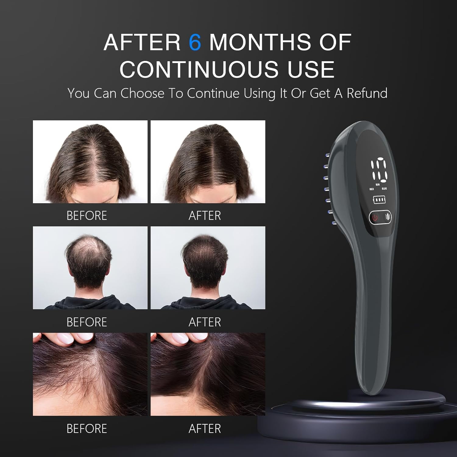 Laser Hair Growth Comb Brush for Men and Women Hair Loss, Hair Regrowth ...