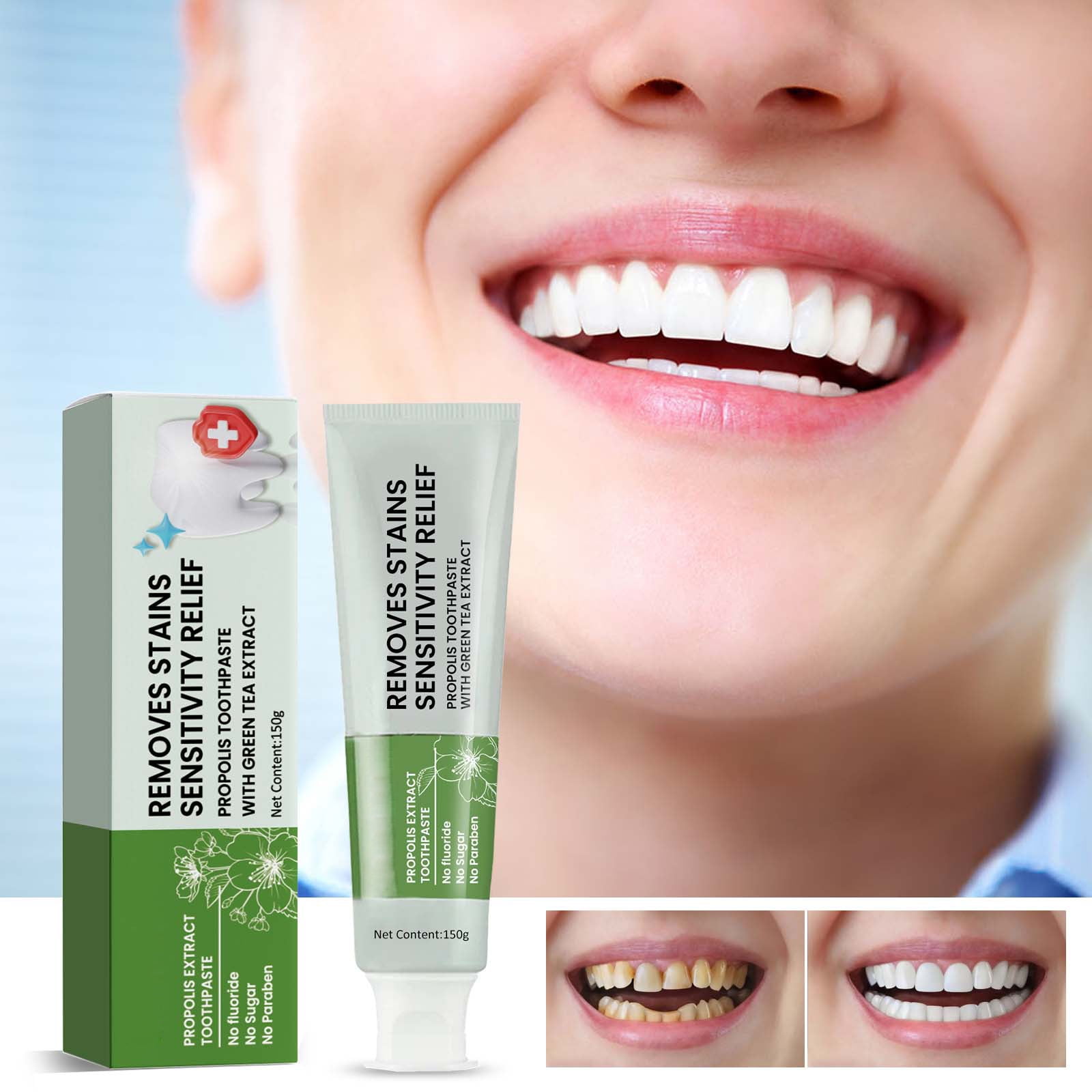 Latrodar Propolis Toothpaste Removes Tooth Stains and Keeps Teeth ...