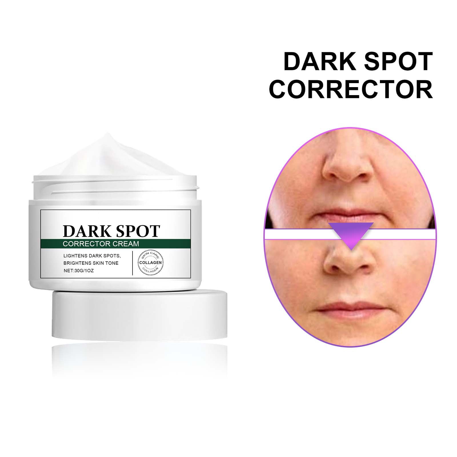 Lawor Dark Spots Repair Cream Fades Spots And Brightens Skin Tone ...