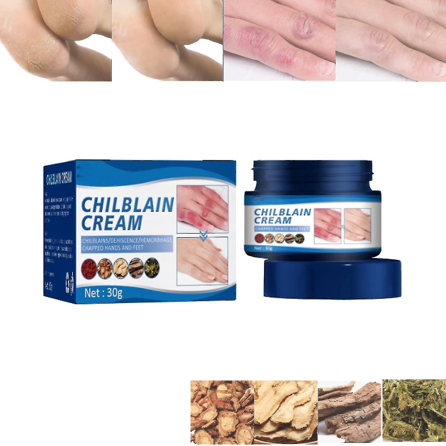 Lblain Cream, Anti- Bite Moisturiser Anti Hand Foot Skin Rep Cream Dry ...