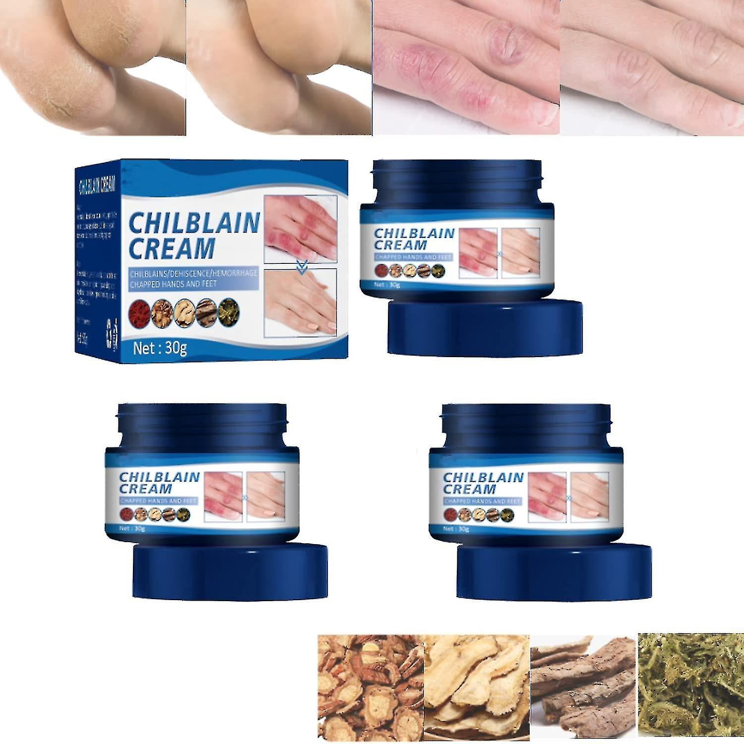 Lblain Cream, Anti- Bite Moisturiser Anti Hand Foot Skin Rep Cream Dry ...