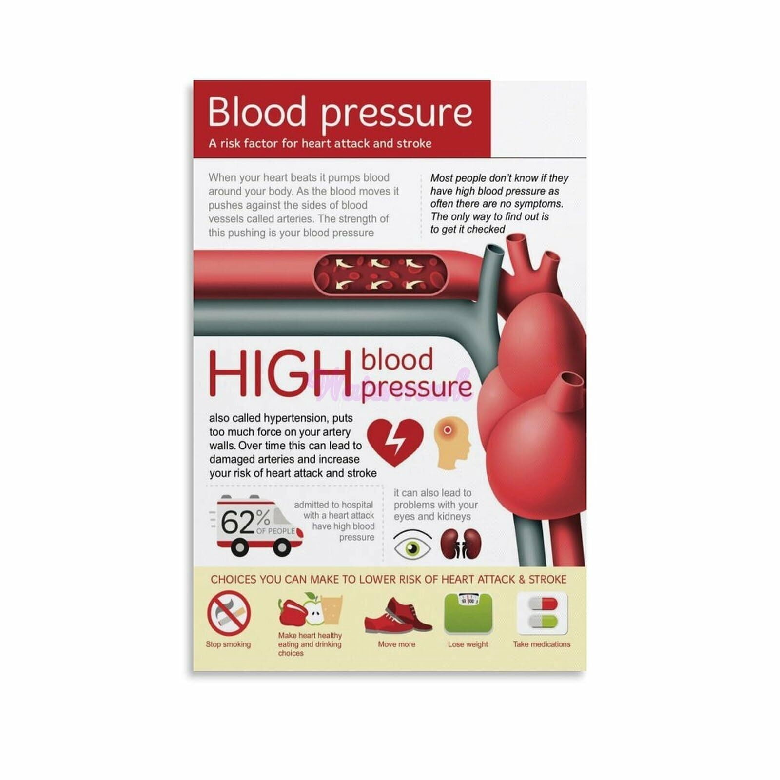 Learn About High Blood Pressure Symptoms Pressure Poster (4) Canvas ...