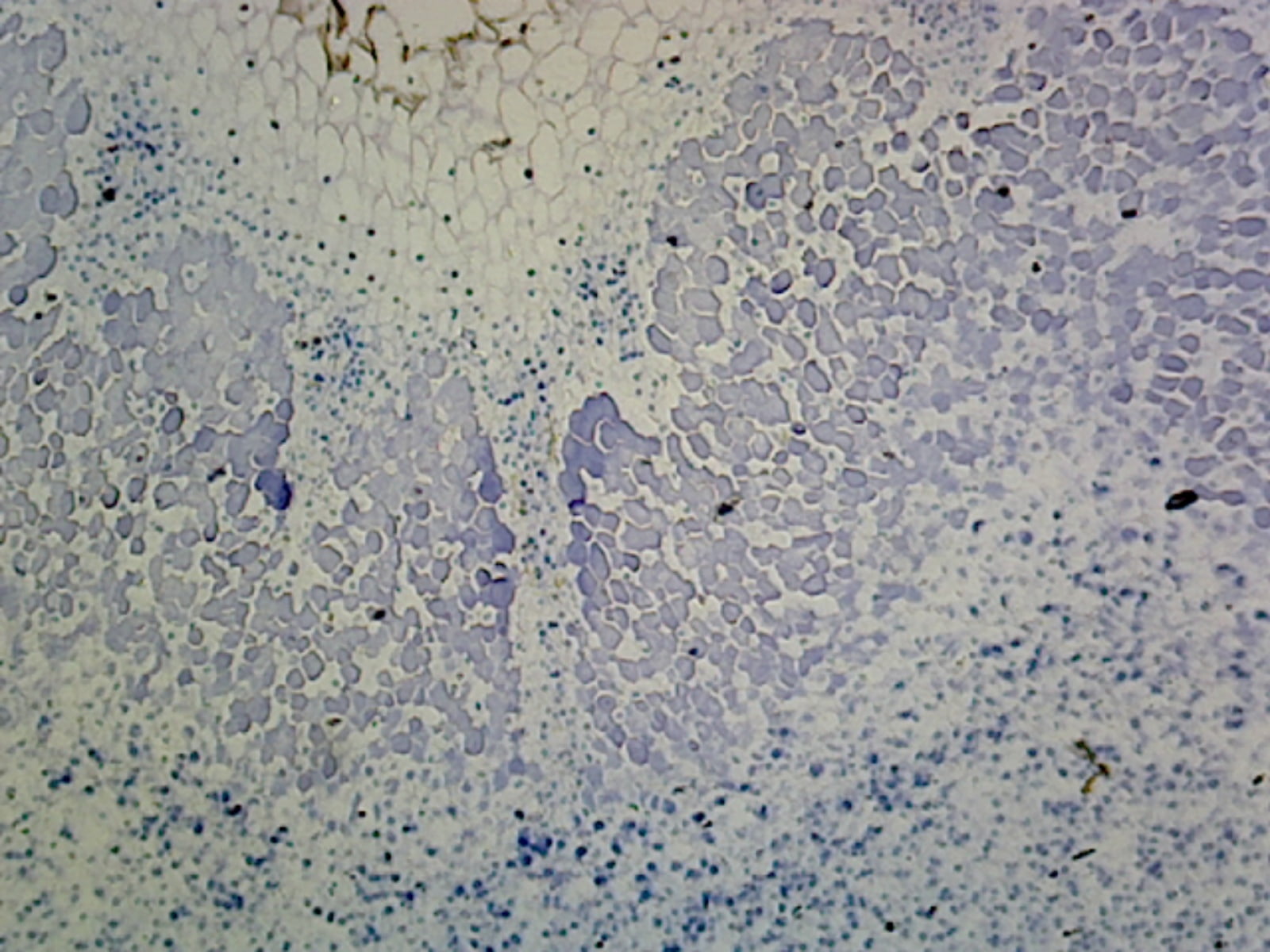 Legume Root Nodule; Section Showing Nitrogen Fixing Bacteria in the ...
