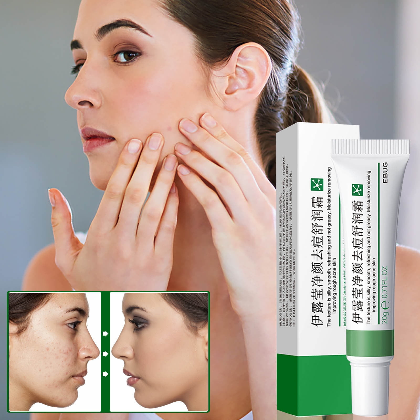 Lenkho Sales Clear Face And-relieving Cream Fade Marks Water And Oil ...