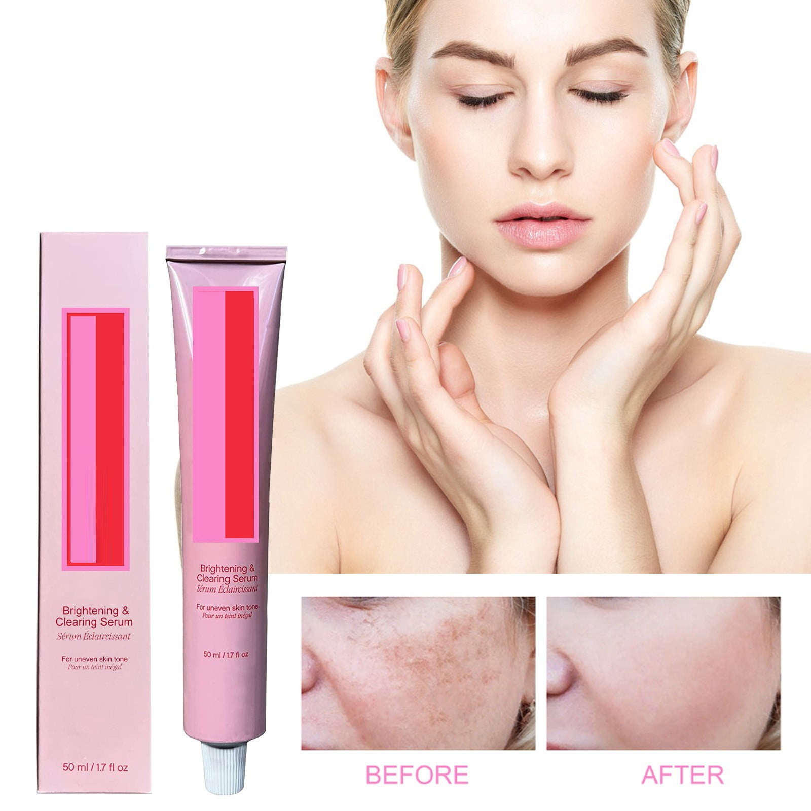Lenkho Sales Vitamin C Serum Hyaluronic Acid Serum Skin Care Dark Spot ...