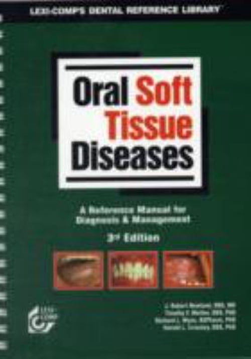 Pre-Owned Oral Soft Tissue Diseases (Paperback) 9781591951056 - Walmart.com