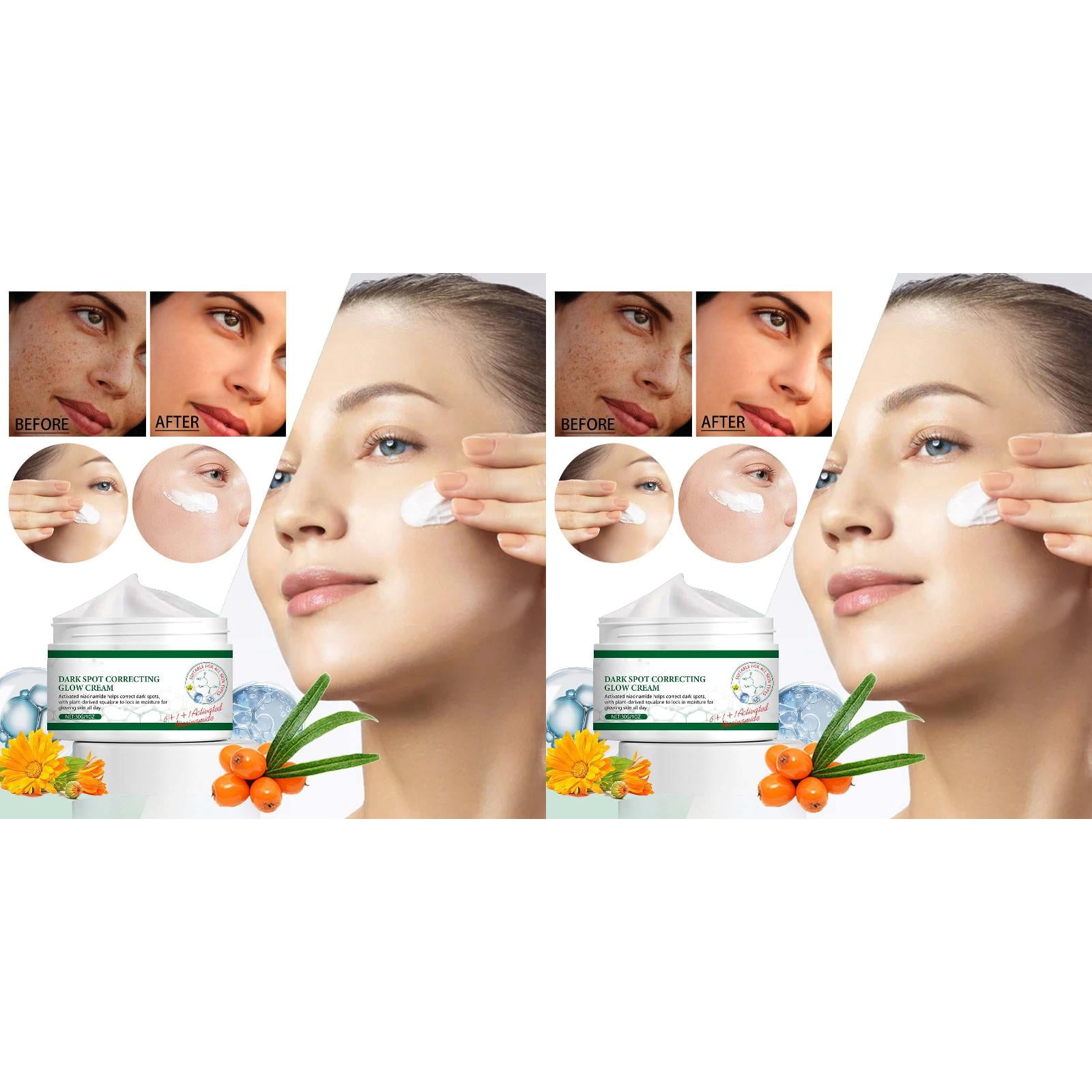 Lighten And Brighten Skin Beautify Skin Tender Skin Dull Skin Care ... Lighten And Brighten Skin Beautify Skin Tender Skin Dull Skin Care ...