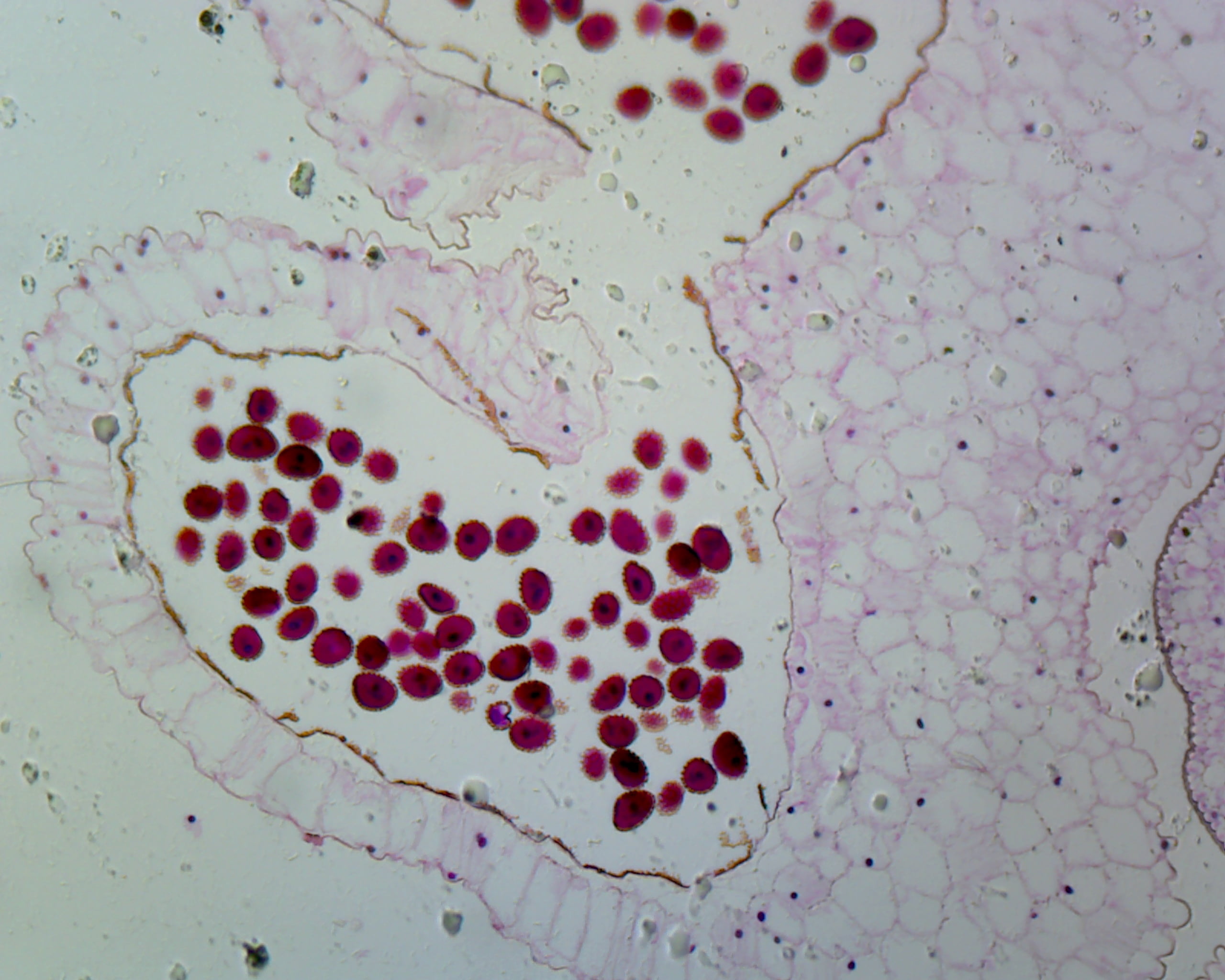 Lilium Anther, First Meiotic Division; Cross Section by Go Science ...
