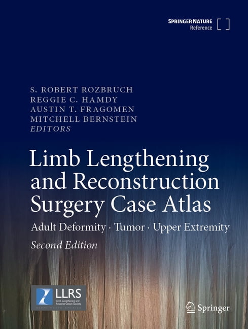 Limb Lengthening and Reconstruction Surgery Case Atlas: Adult Deformity ...