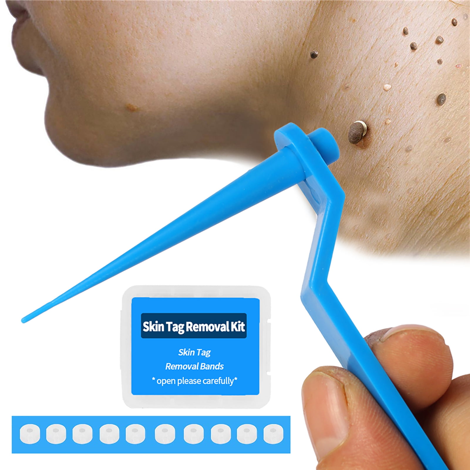 Skin Tags Removal