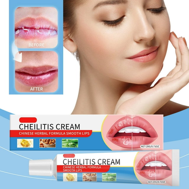 Lip Cream For Cheilitis 2025 New Cheilitis Lip Treatment Cream Moisturizing Lip Repair