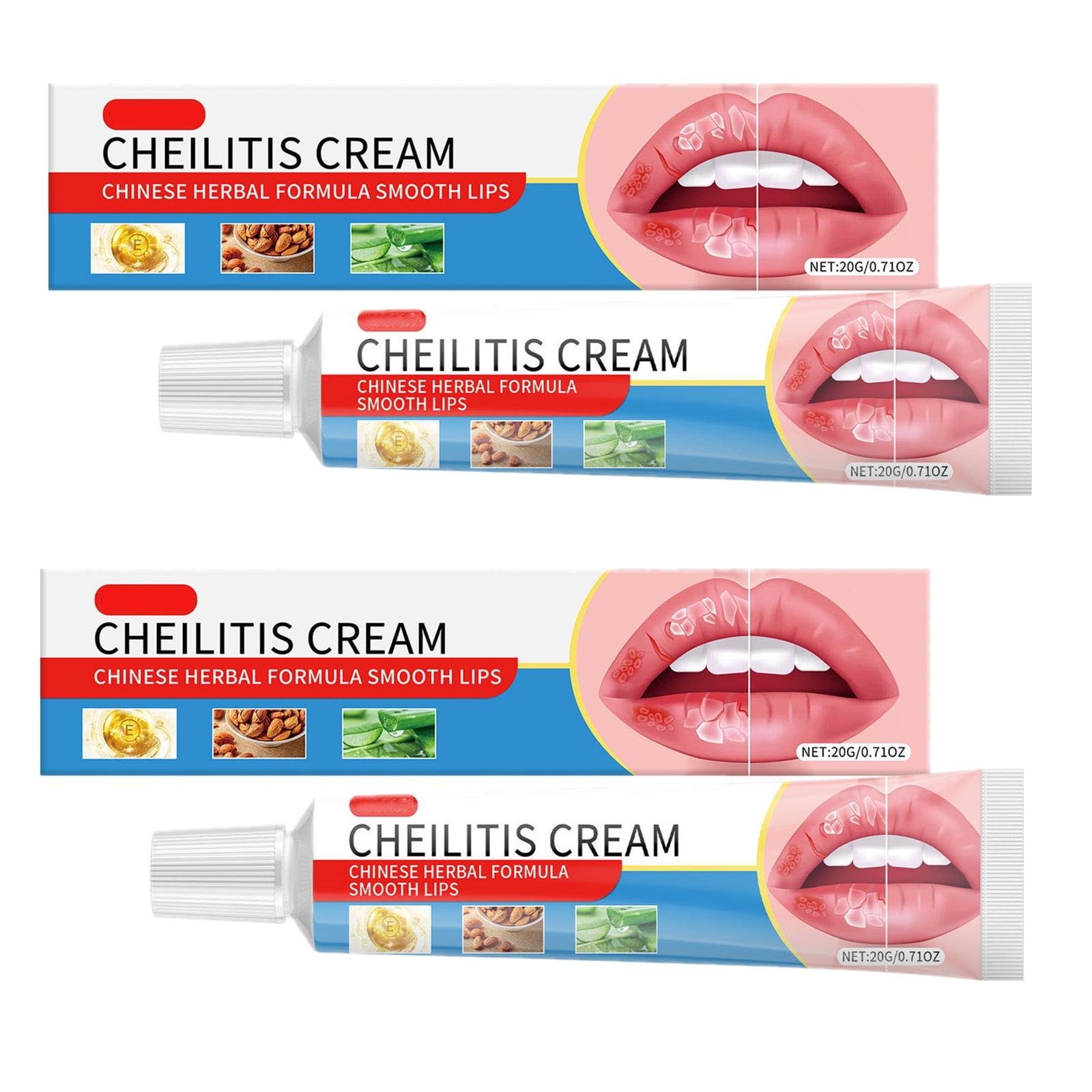 langlia Lip Cream for Cheilitis, Dry and Cracked Lips Treatment ...