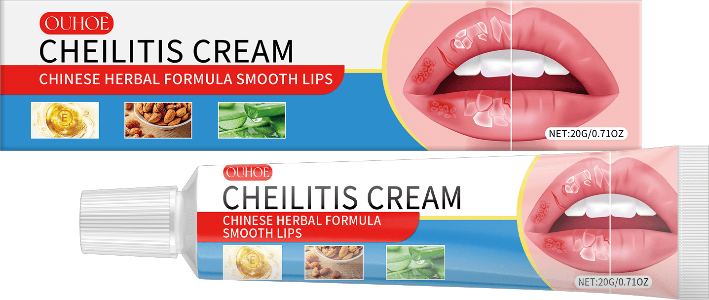 Lip Cream for Cheilitis, Cheilitis Lip Treatment Cream, Hydrating Lip ...