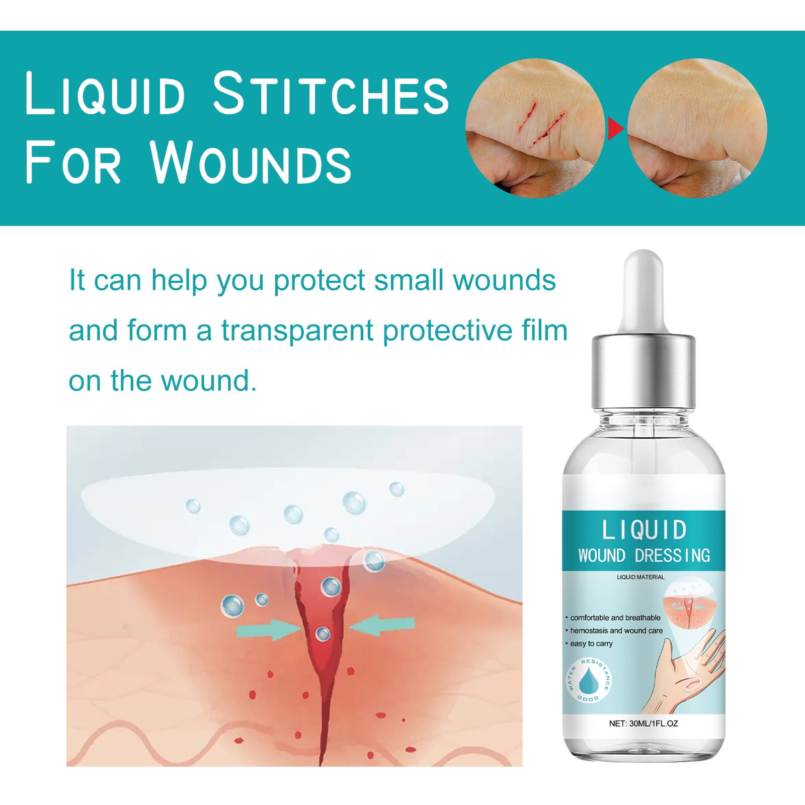 Liquid Bandage Drops,Liquid Wound Suture,Wound Glue Reduce And Isolate ...