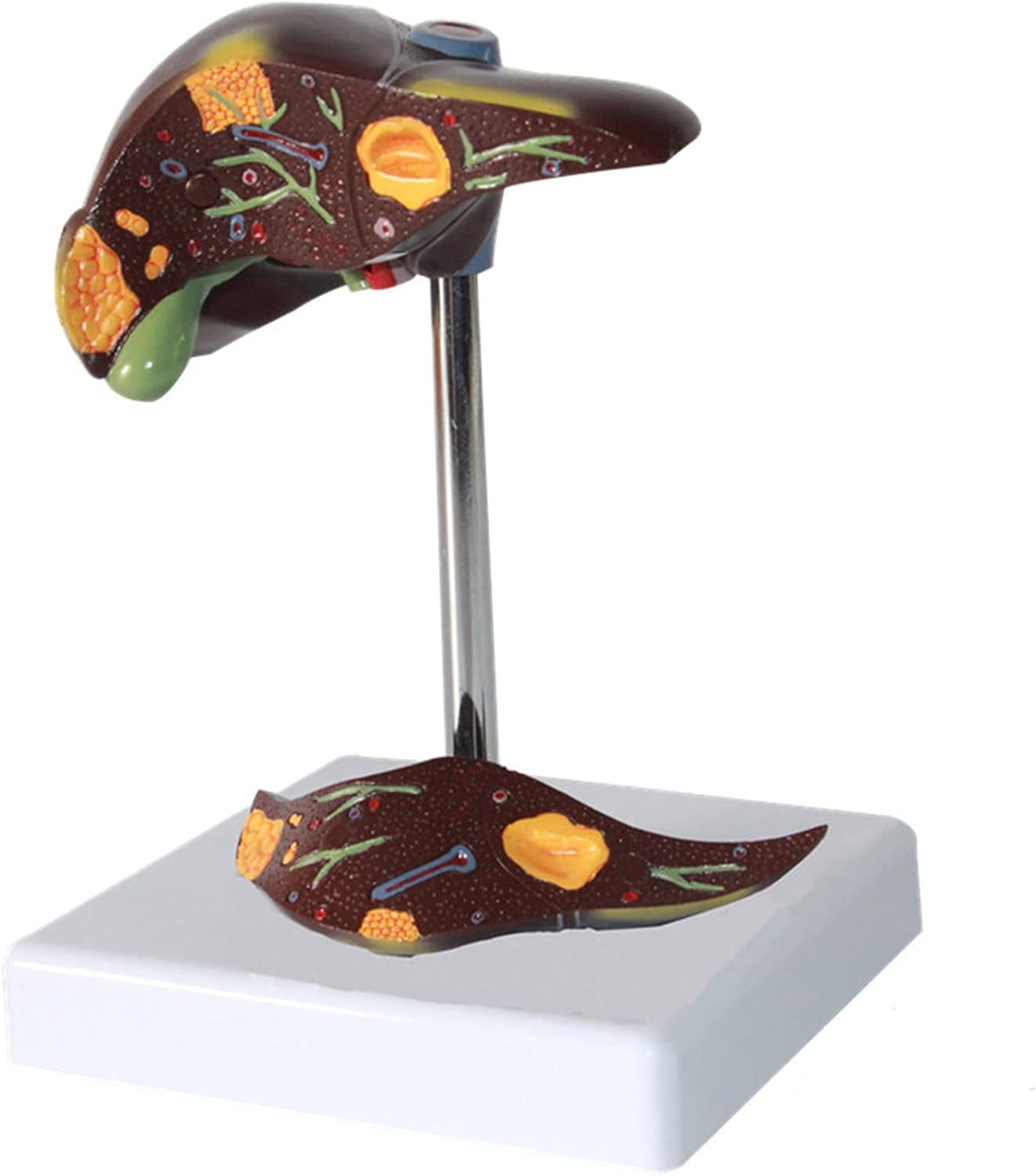 Liver Anatomy Model, Human Liver Disease Model, Liver Fat/Cirrhosis ...