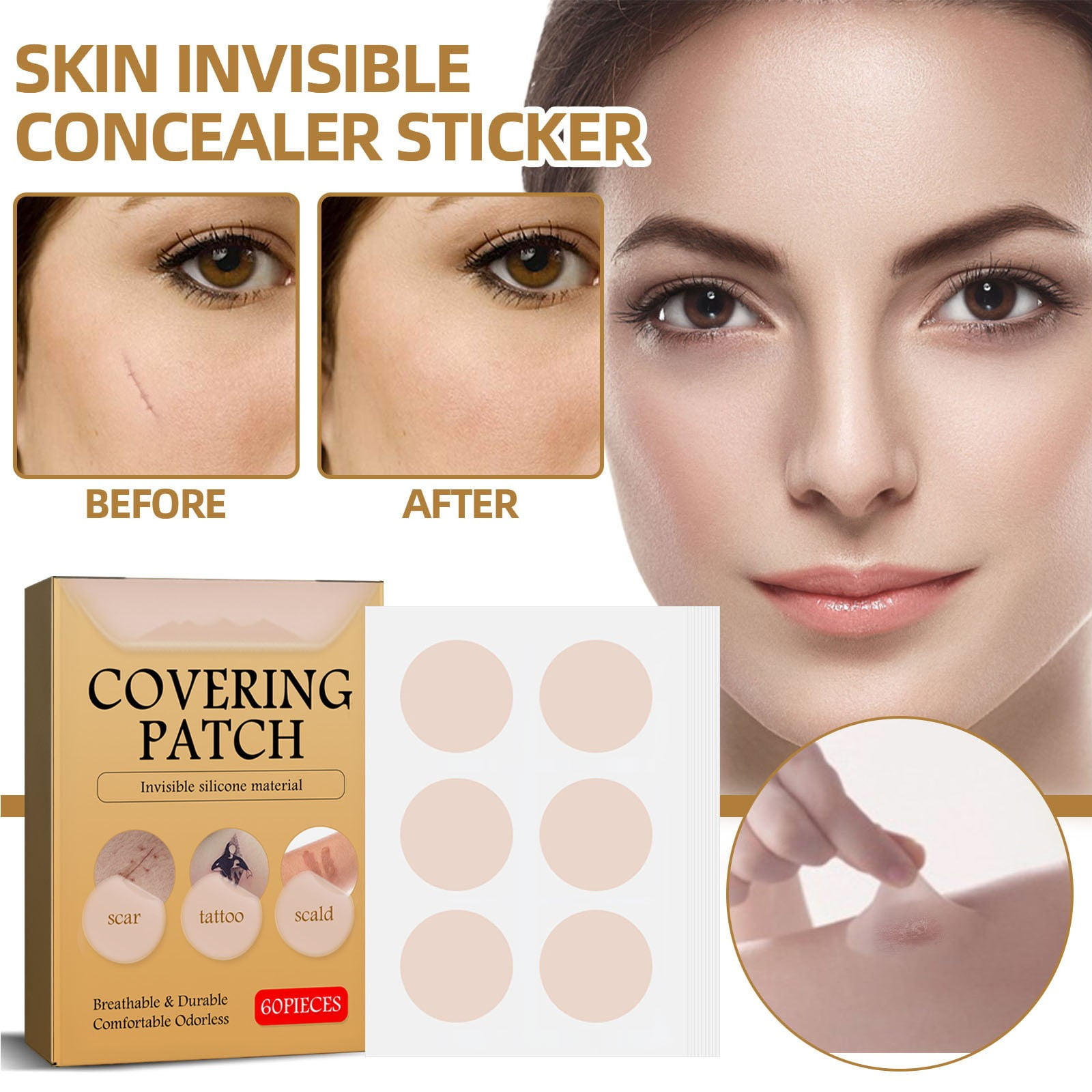 LoTiSee Skin Concealer Patch, Skin Scar Acne Mark Cover Patch Skin ...