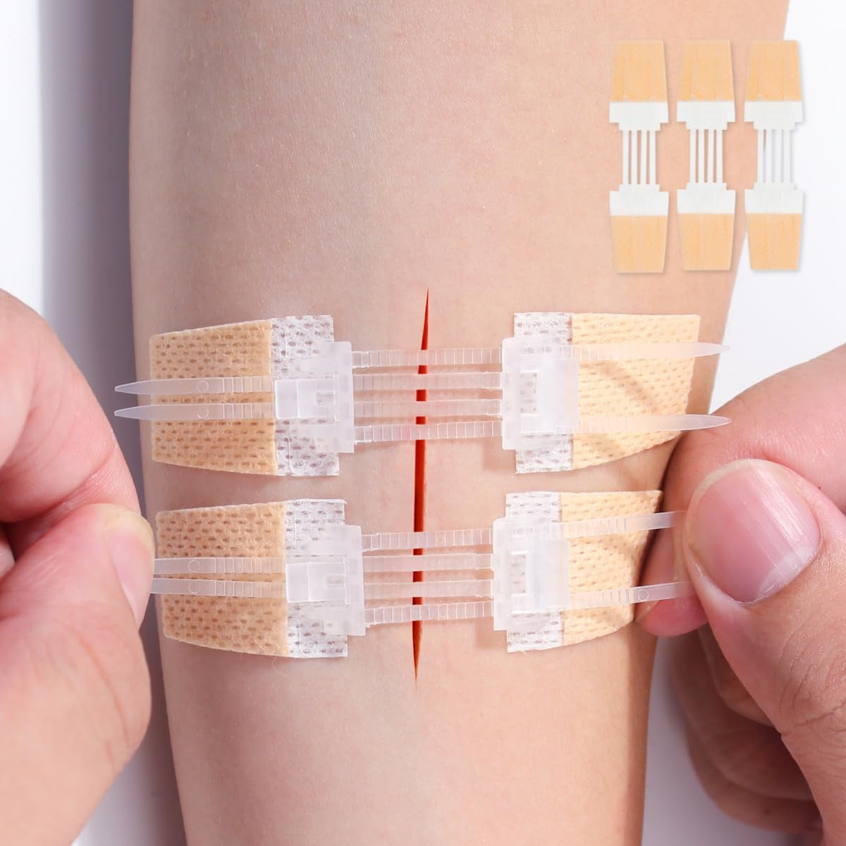 Longmed Emergency Wound Closures - 3 Pcs Butterfly Bandages Adhesive ...