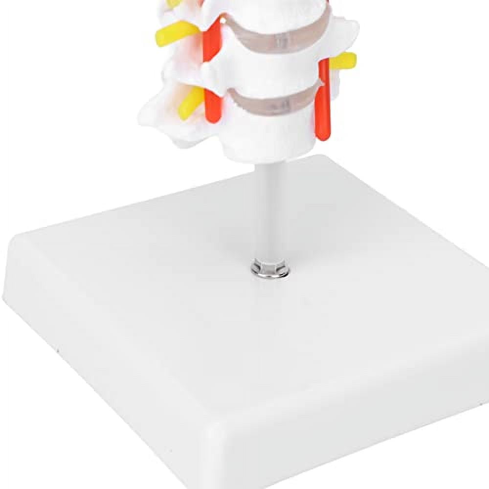 Lumbar Spine Model, Human Lumbar Vertebrae Anatomy Model Anatomical ...