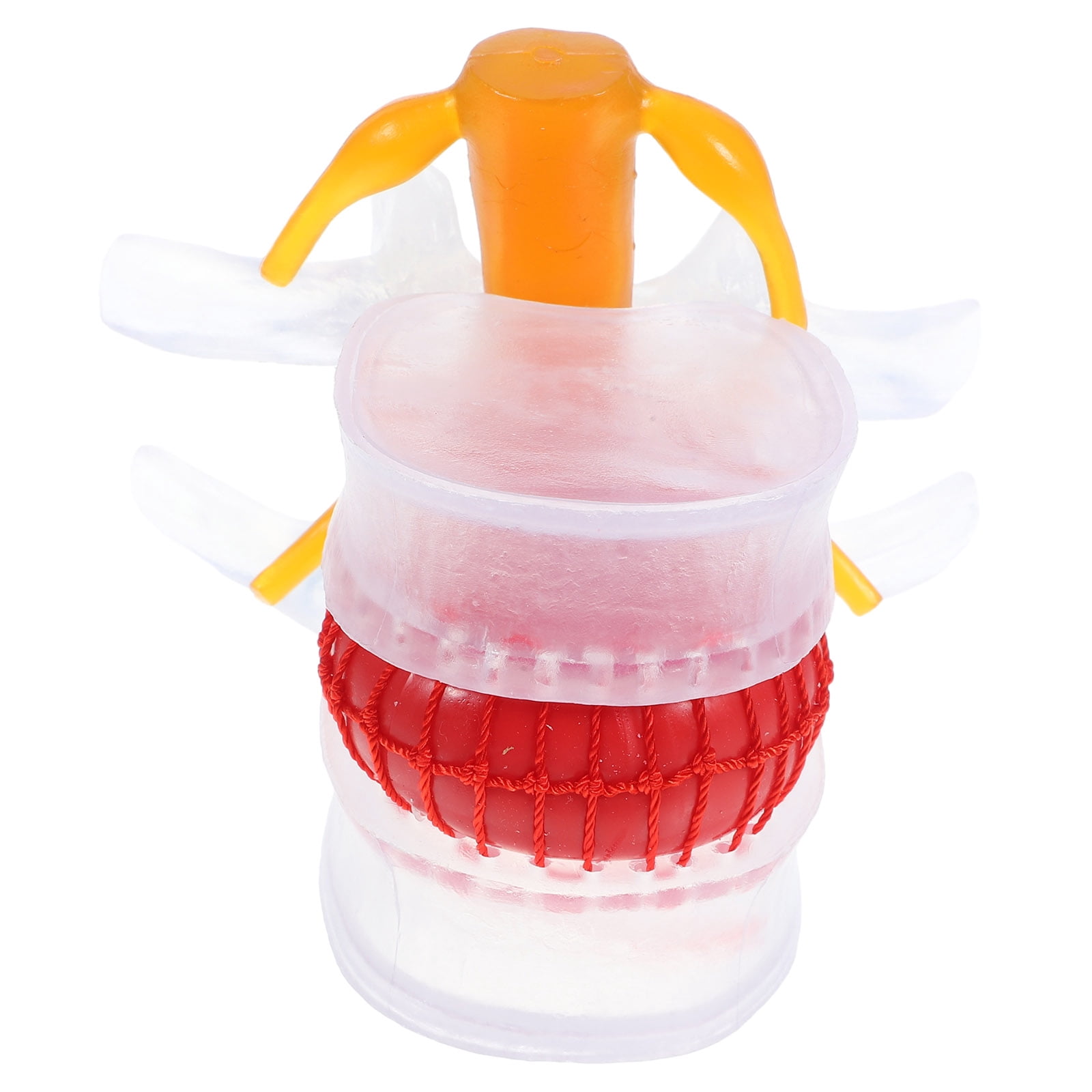 Lumbar Spine Model Models for Demonstration Disc Herniation Teaching ...