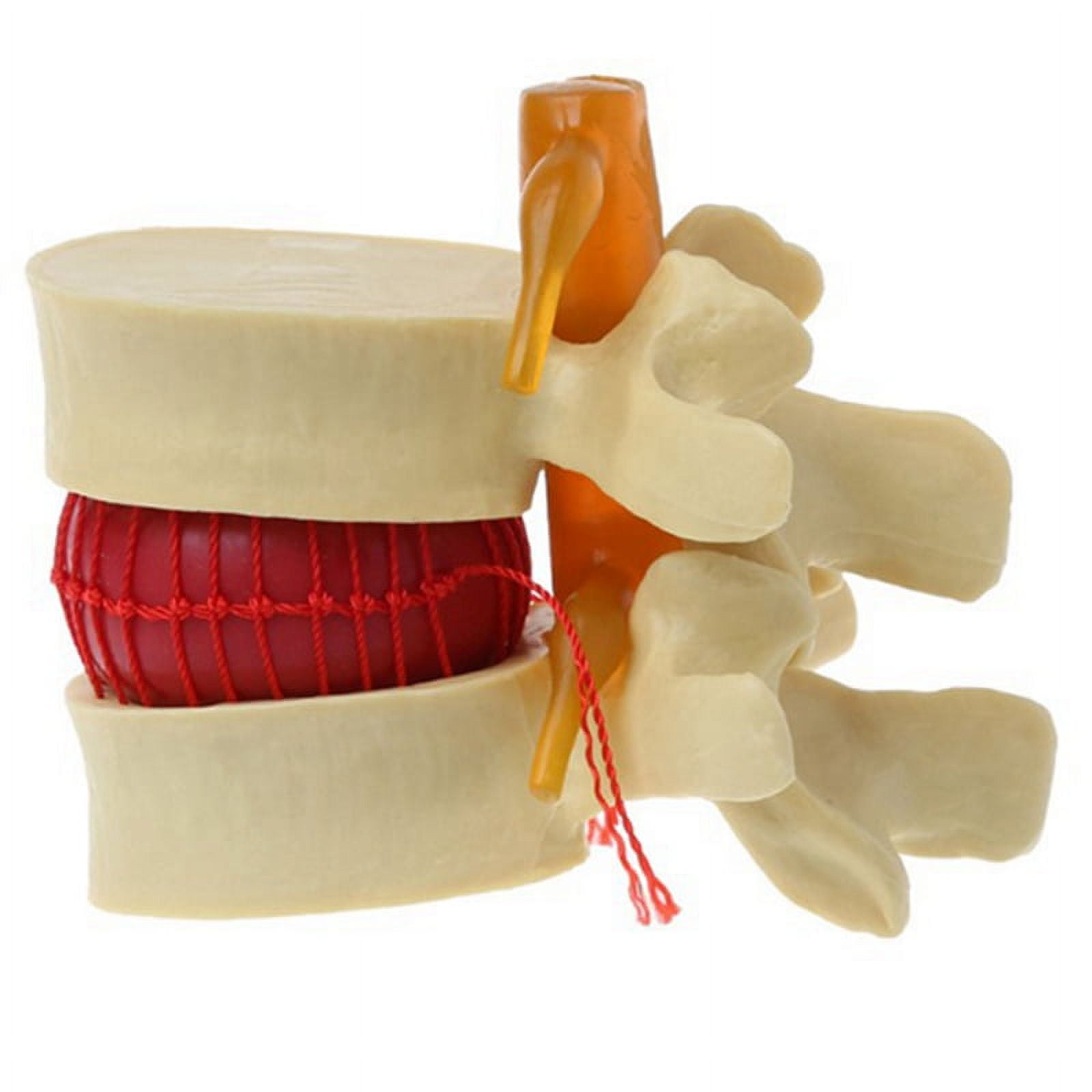 Lumbar Vertebrae Model Anatomical Spine Lumbar Disc Herniation Anatomy ...
