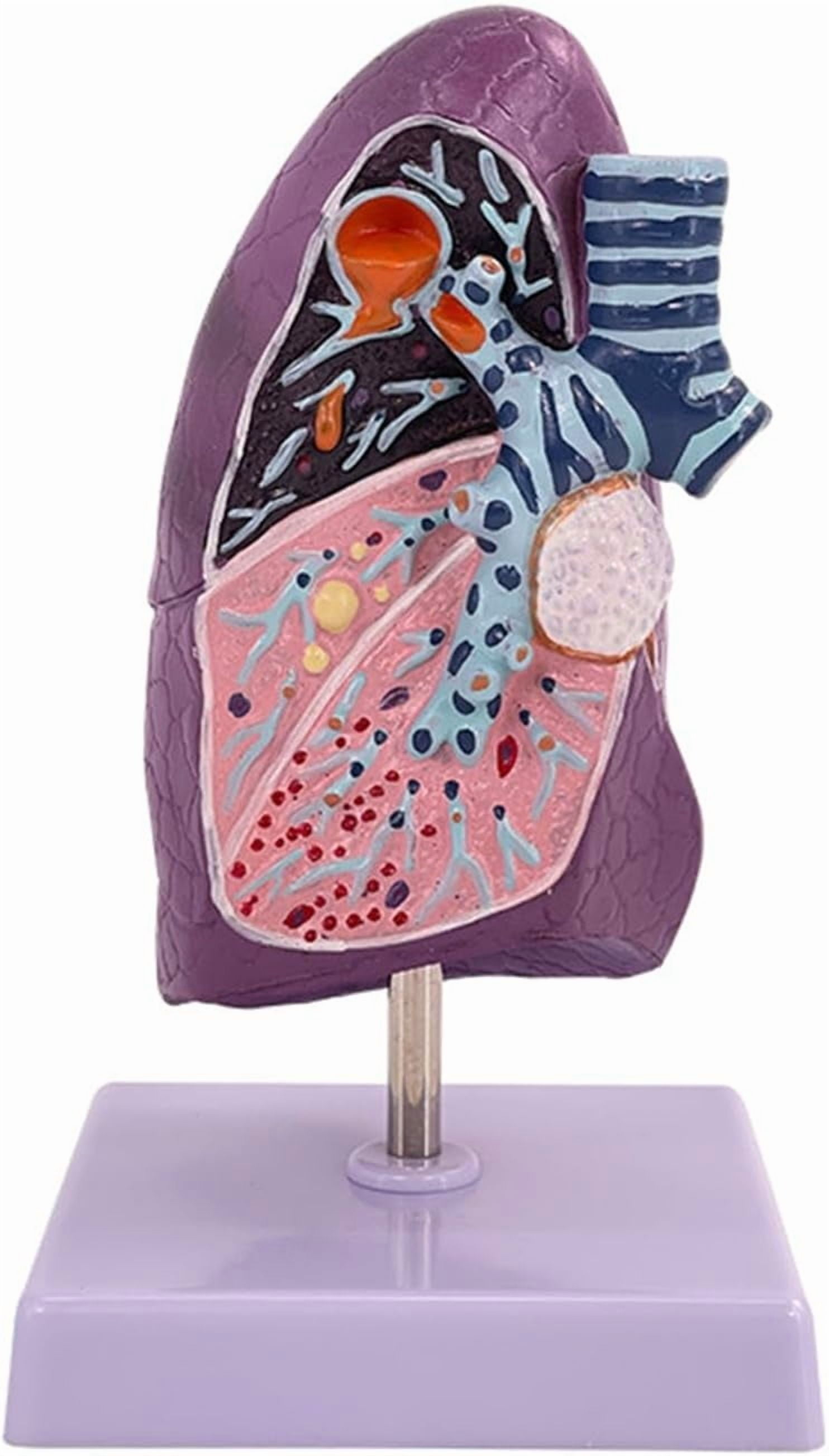 Lung Anatomy Model, Pathological Lung Model with Base and Clear Texture ...