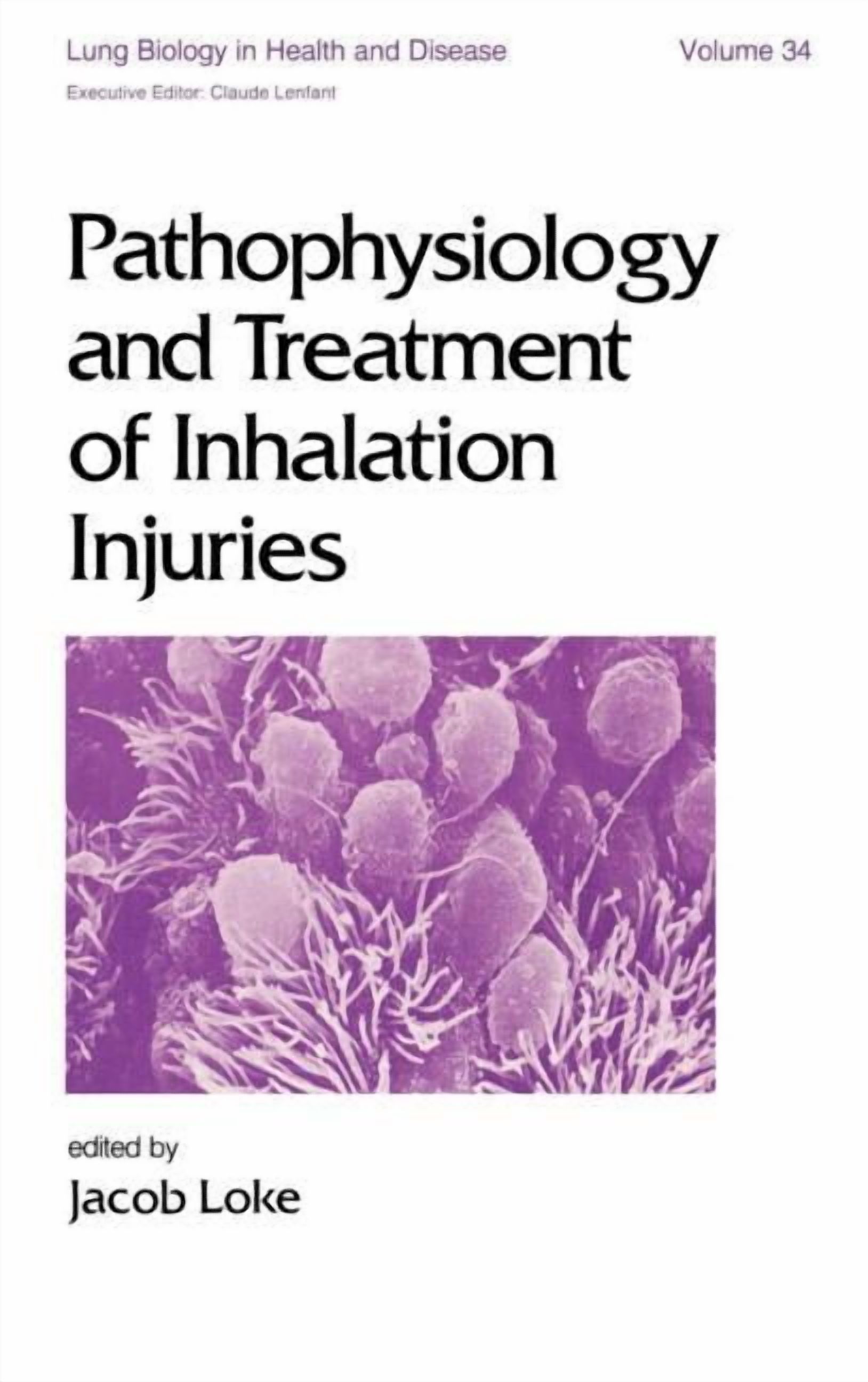 Lung Biology in Health and Disease Pathophysiology and Treatment of ...