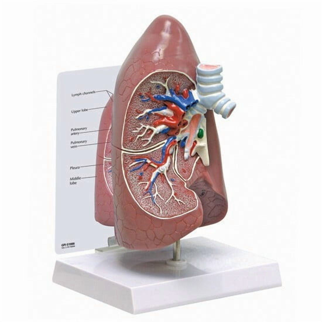 Lung Normal Anatomical Model GPI LFA #3100 SEE VIDEO - Walmart.com