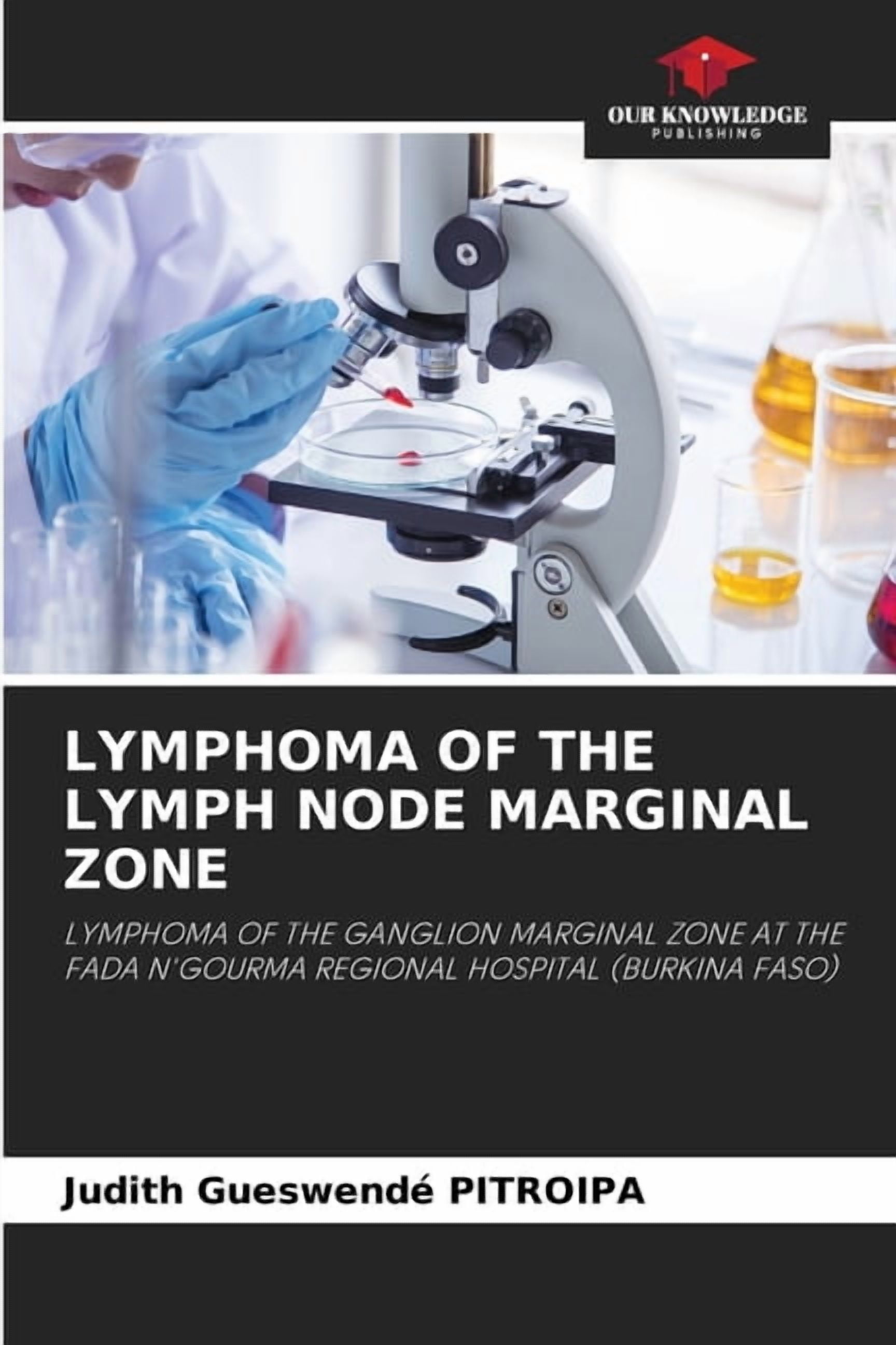 Lymphoma of the Lymph Node Marginal Zone, (Paperback) - Walmart.com