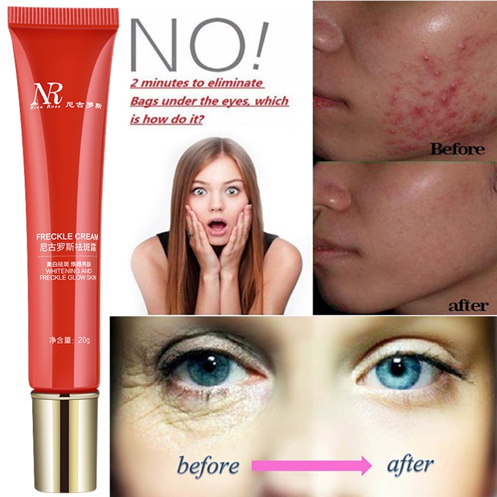 Lyzmus Reduced Beauty Tools Soft -wrinkle Extract Removal Marks Facial ...