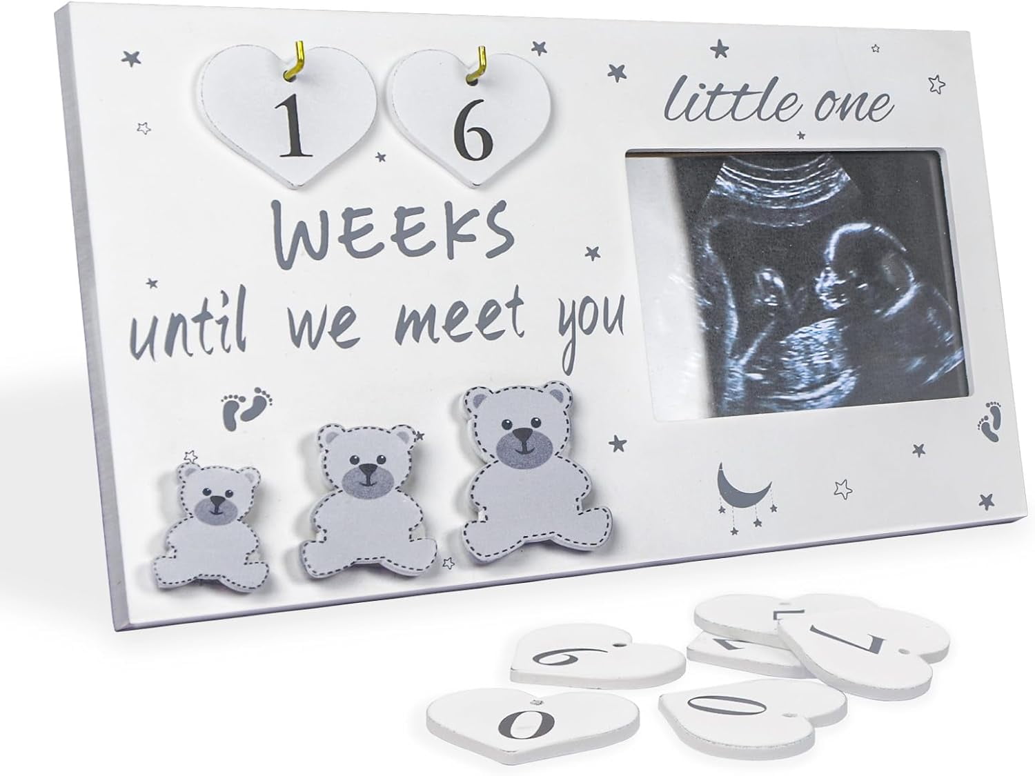 MAKEGELD Ultrasound Picture Frames, Sonogram Picture Frame with Baby ...