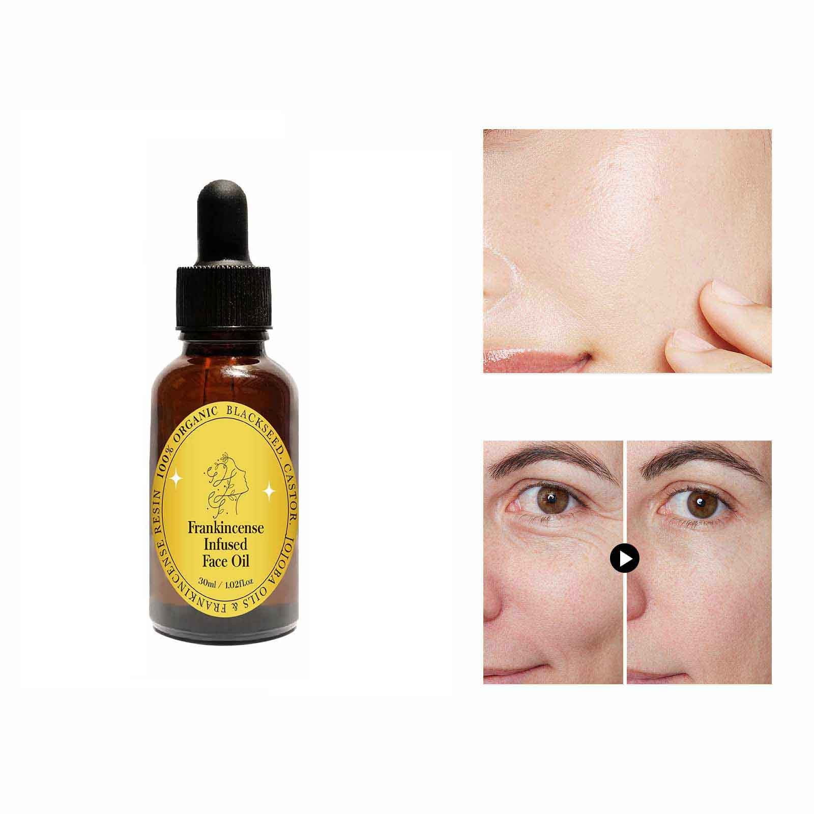 MAUXDA Frankincense Resin Infused Organic Black Seed, Castor & Jojoba Oils for Face Anti-Aging ...