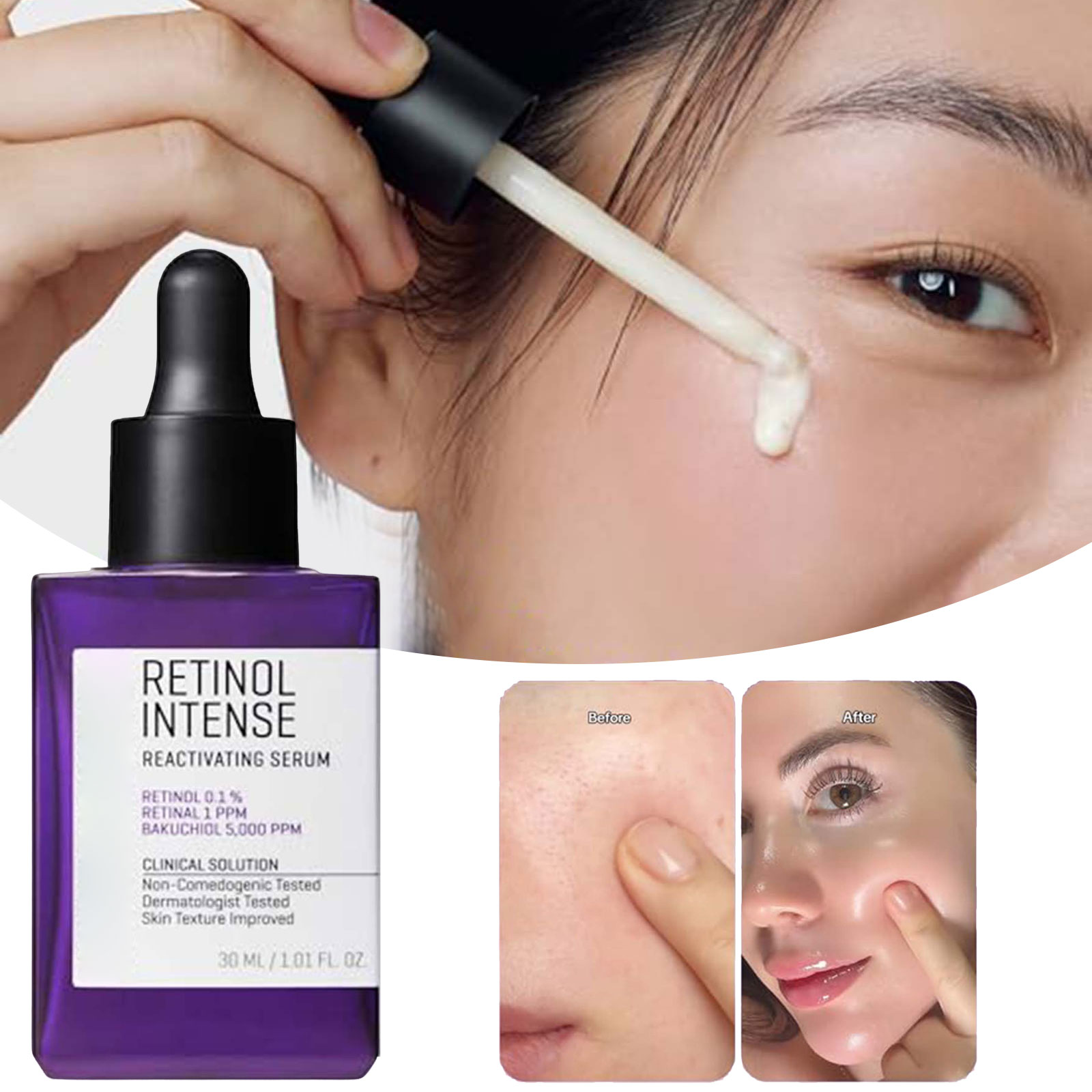 SOME BY MI Retinol Intense Minimizes Pore Size & Refines Skin Texture ...