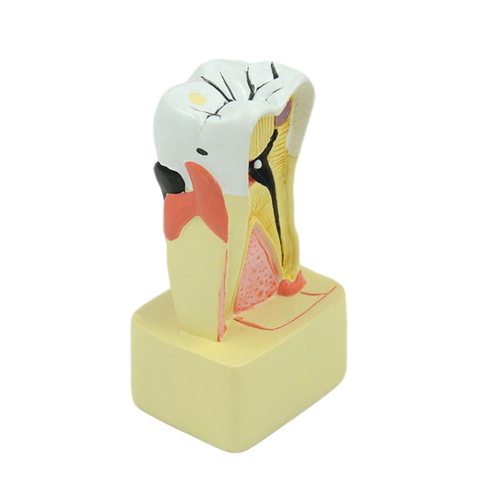 MOMOJIA Pathology Teeth Model Periodontal Disease Model Analysis ...