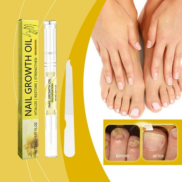 Movawaky French Manicure Pen Toenail Grinder For Thick Toenails Human