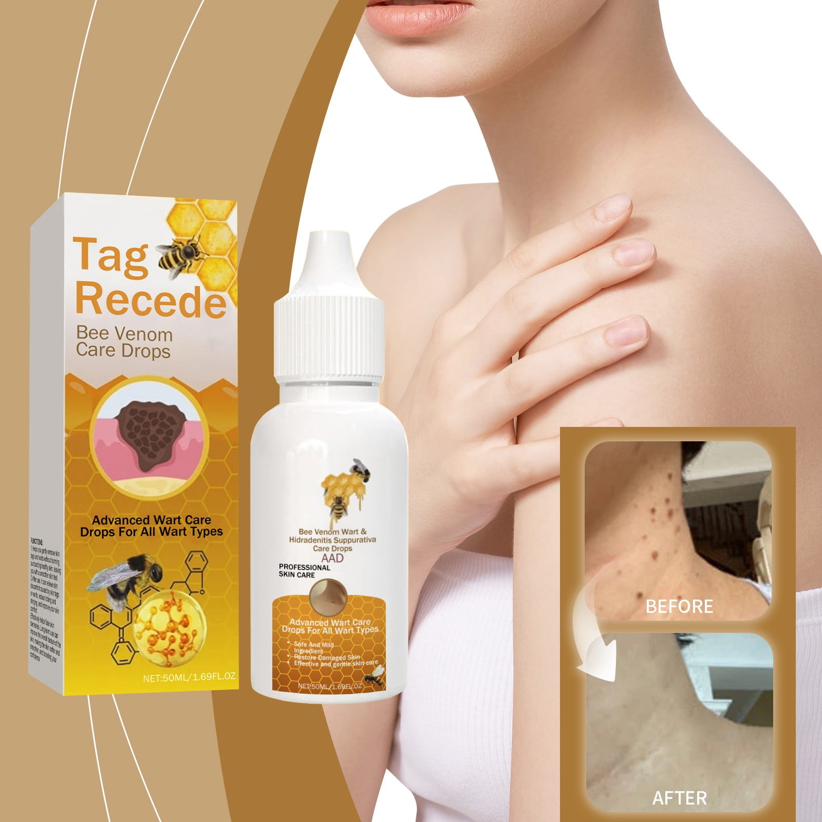 MOVAWAKY Infused Wart Removal Care Drops Harnessing Nature's Power For Precision Wart ...