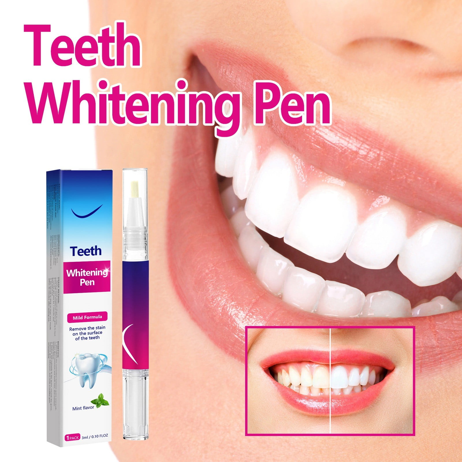 MOVAWAKY Teeth Cleaning Pen Deep Cleansing Odor Teeth Stains Fresh ...