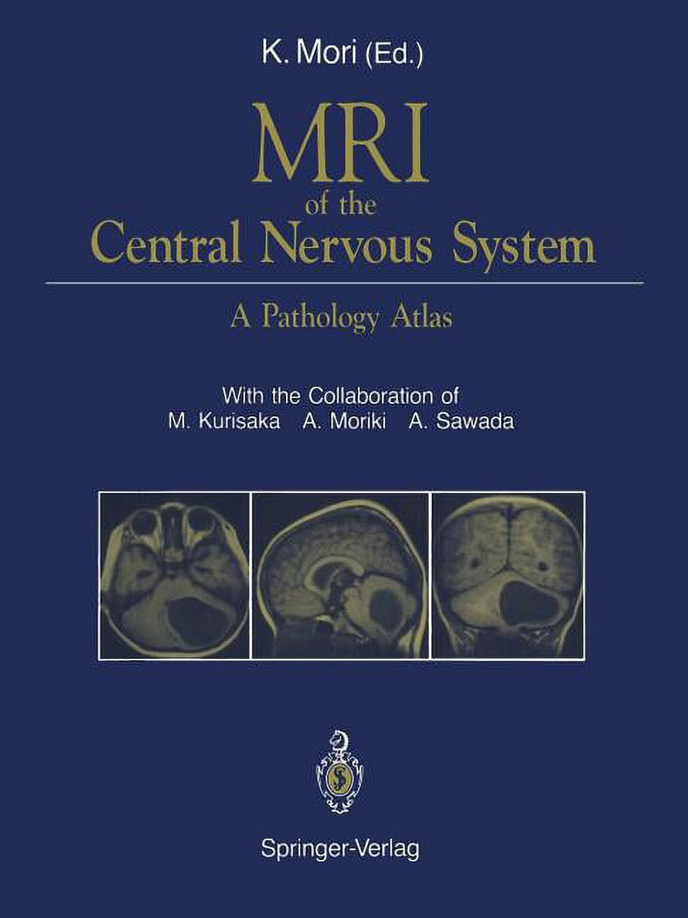 MRI of the Central Nervous System: A Pathology Atlas, (Paperback ...