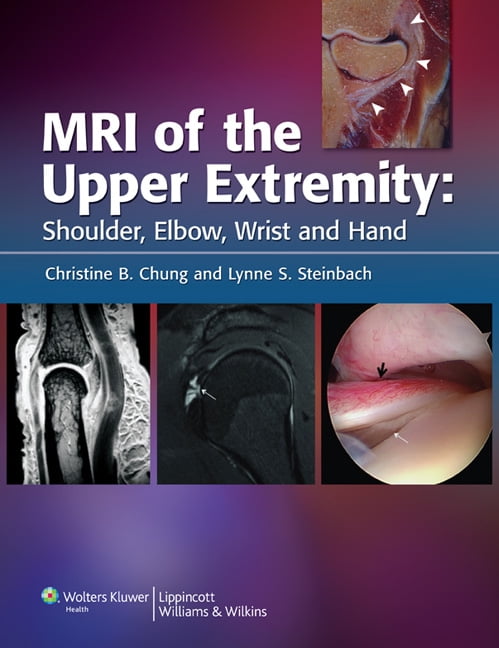 MRI of the Upper Extremity : Shoulder, Elbow, Wrist and Hand - Walmart.com