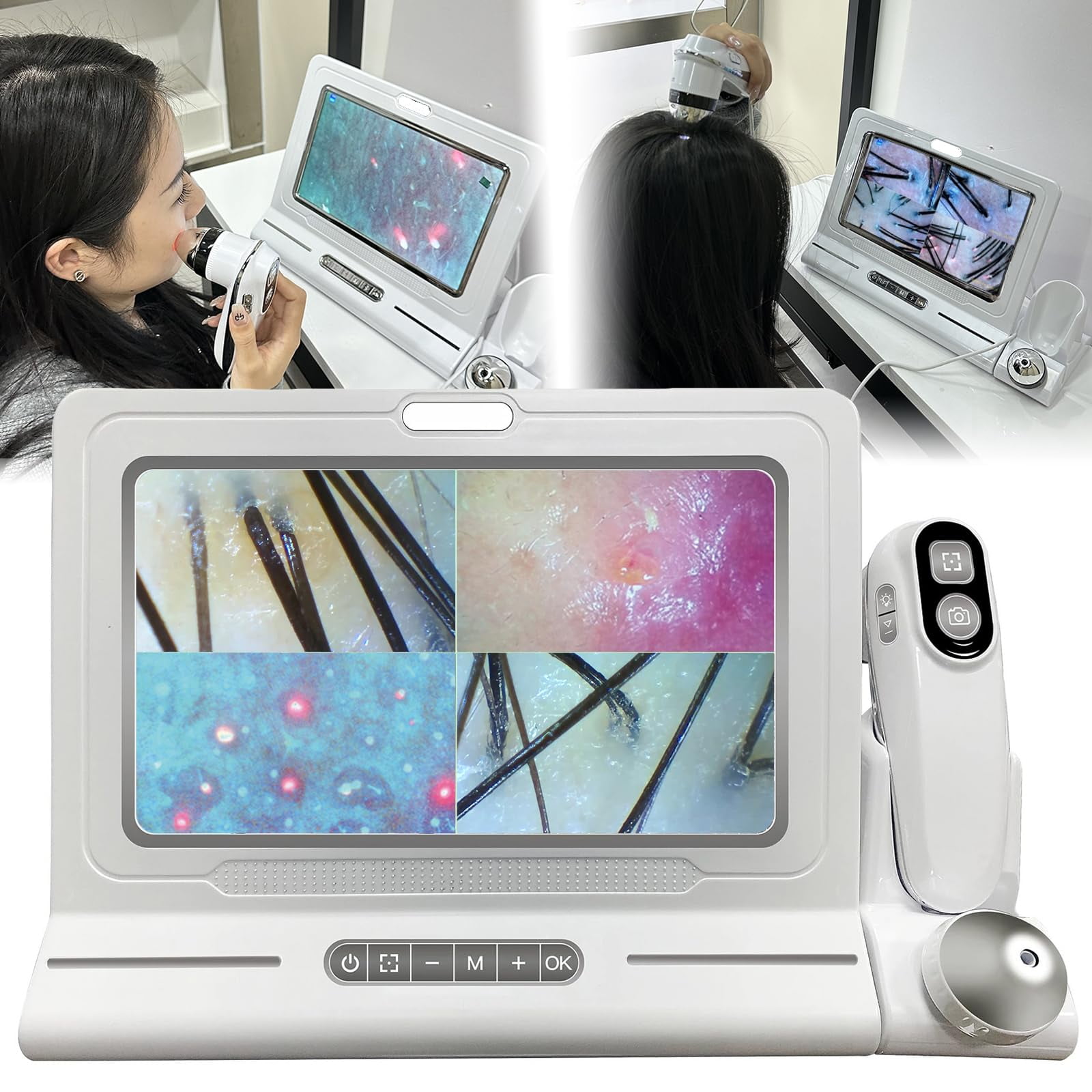 MUCHUNBY Skin Diagnosis Hair Analyzer,11-inch Skin Scalp Detector ...