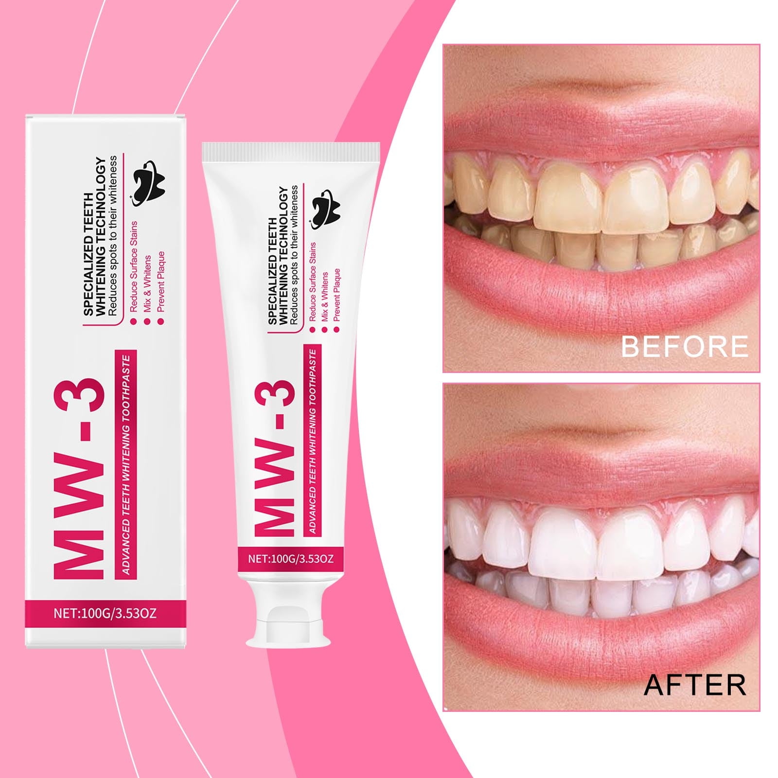 MW-3 Whitening Toothpaste 100g, Fresh Breath, Stain Removal & Tartar ...
