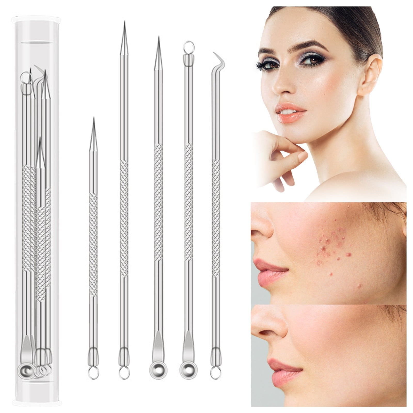 Make-up Skincare Stainless Steel Acne Clips Cell Clips Acne Needles ...