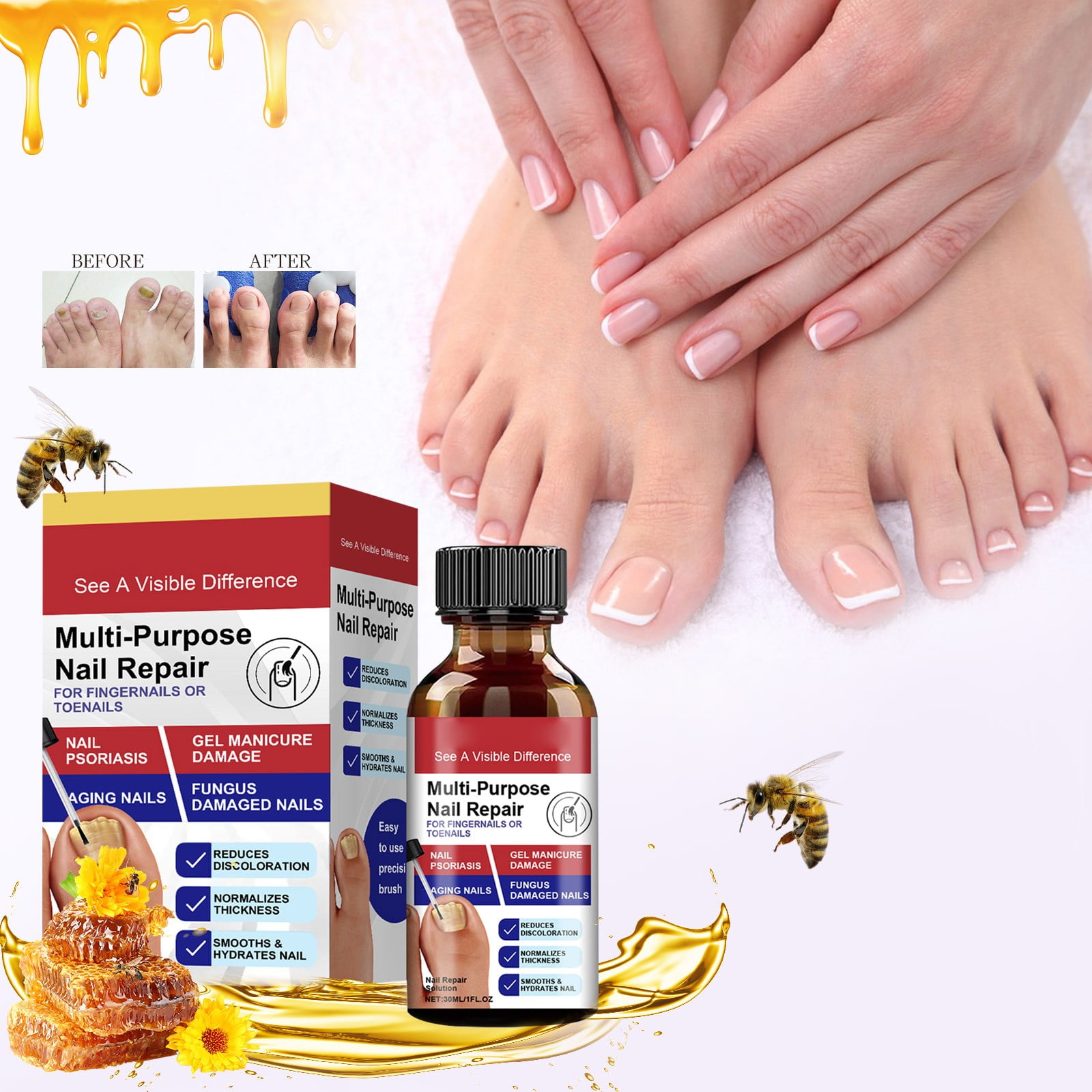 Makeup Toenail Fungus Super Strength Serum, Nail Care Solution ...