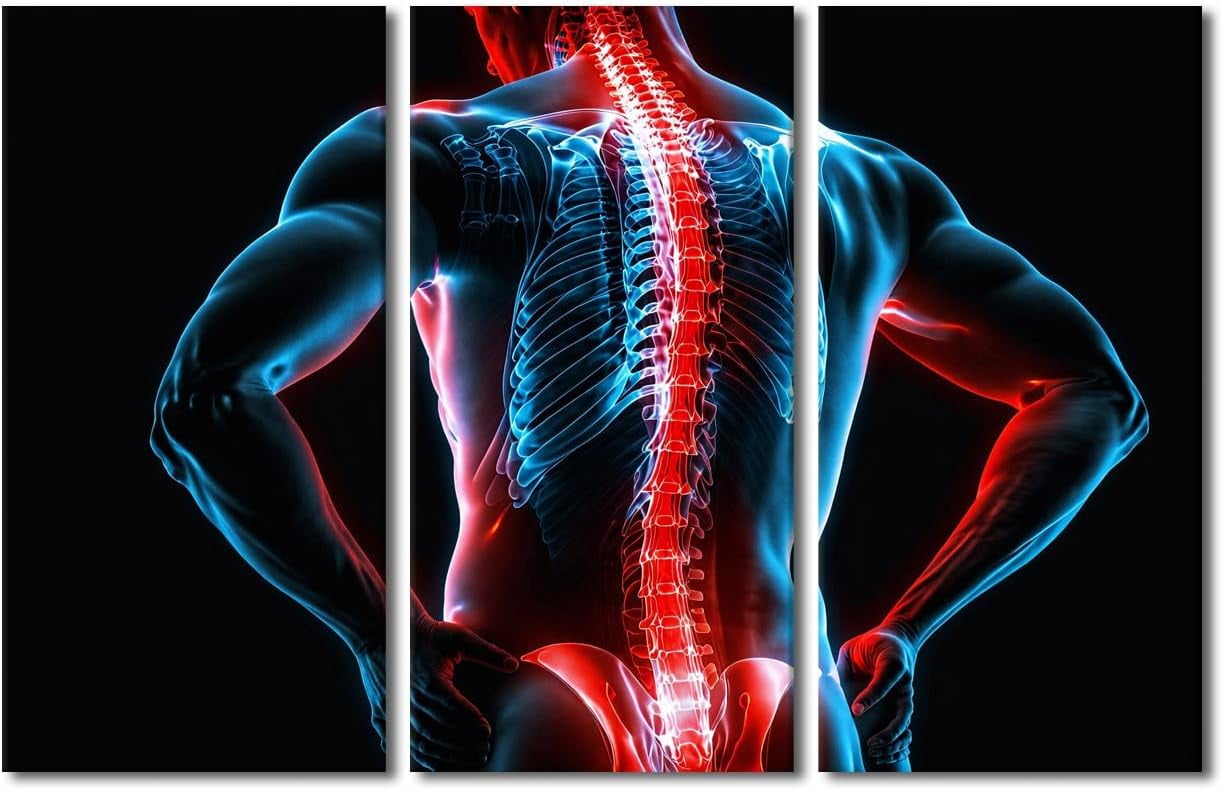 Male Back X-Ray Canvas Wall Art Medical Examination Posters and Prints Art Wall for House Human ...