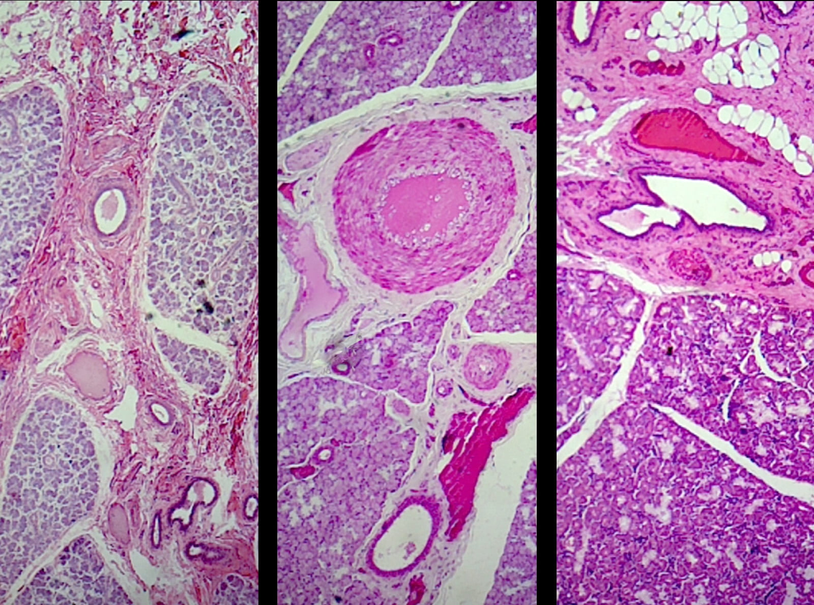 Mammalian Salivary Glands Composite; Showing Sublingual, Submaxillary ...