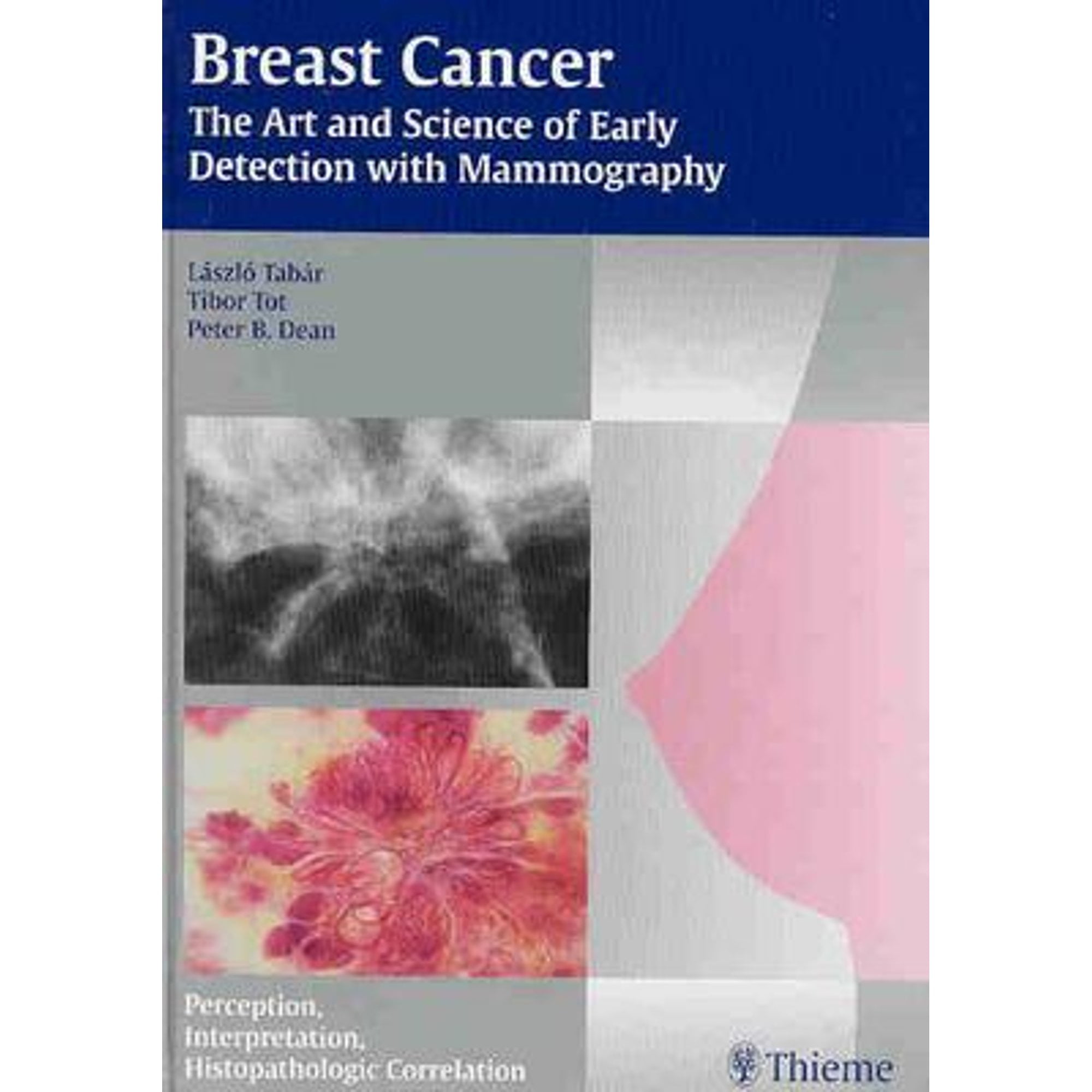 Pre-Owned Breast Cancer: The Art And Science Of Early Detection With ...