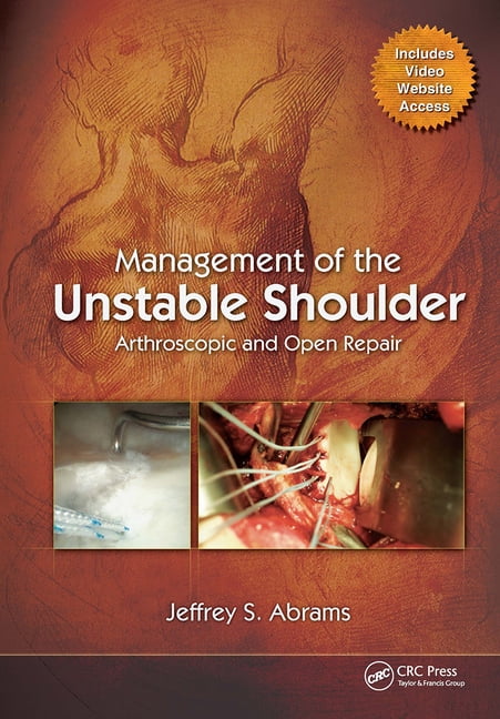 Management of the Unstable Shoulder: Arthroscopic and Open Repair ...