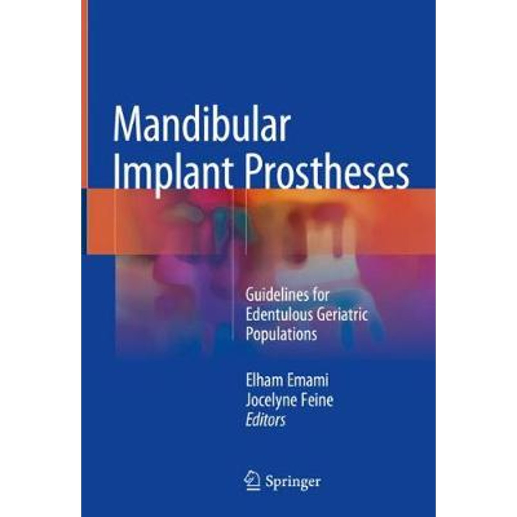 Pre-Owned Mandibular Implant Prostheses: Guidelines for Edentulous ...