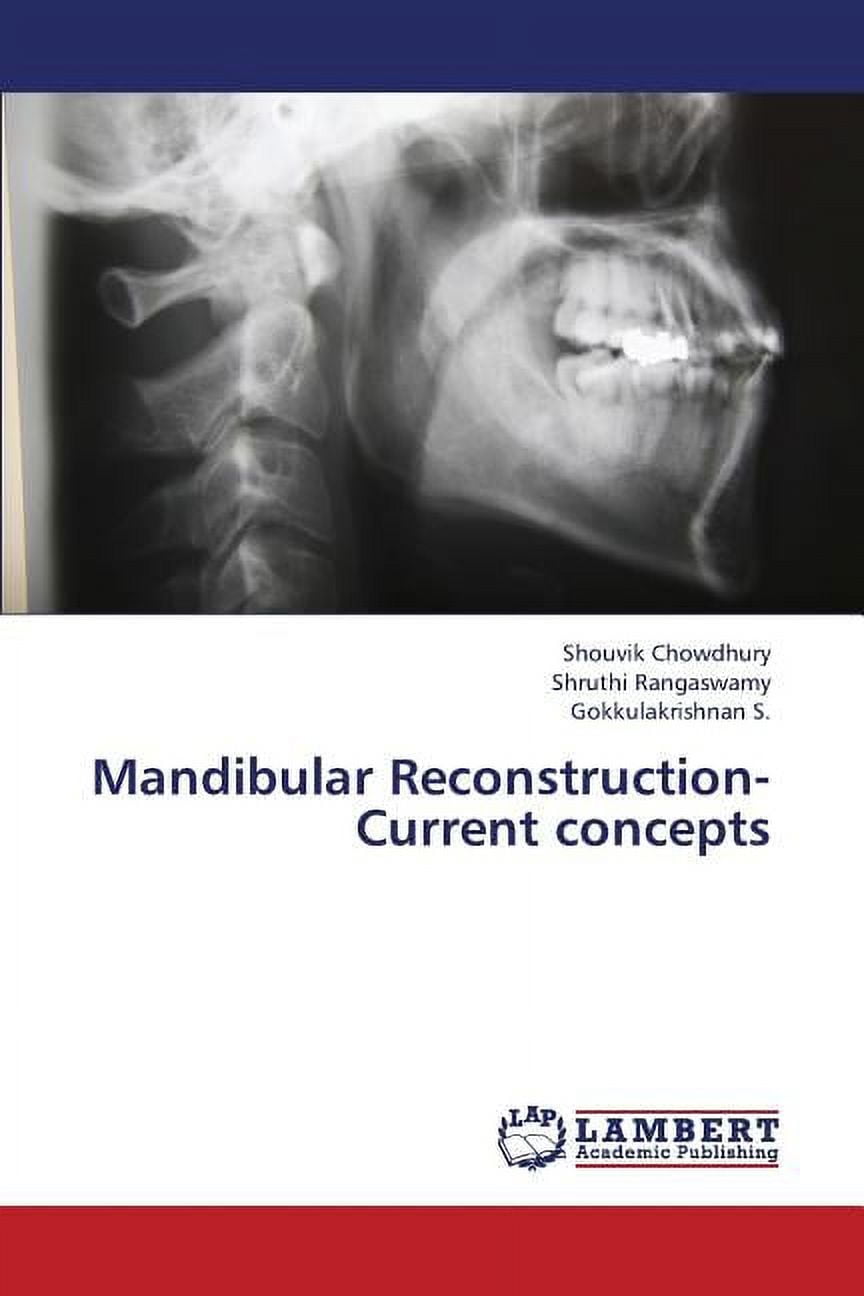 Mandibular Reconstruction- Current Concepts (Paperback) - Walmart.com