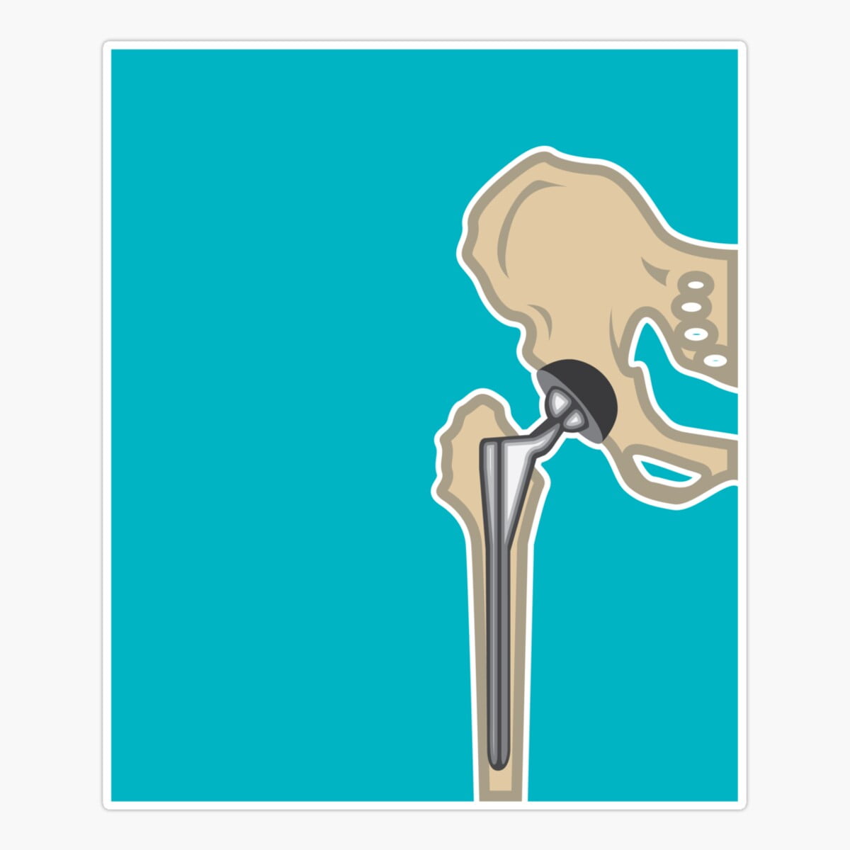 Maneki Hip Joint Replacement Er, Phone Decal Water Bottle Stickers Car ...